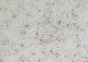 Observación de estomas en un hoja – Monitorización del huerto